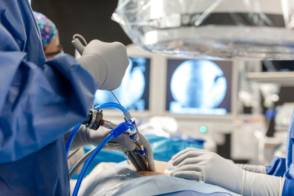 Endoscopic Spine Surgery - Khobragade Multispeciality Hospital